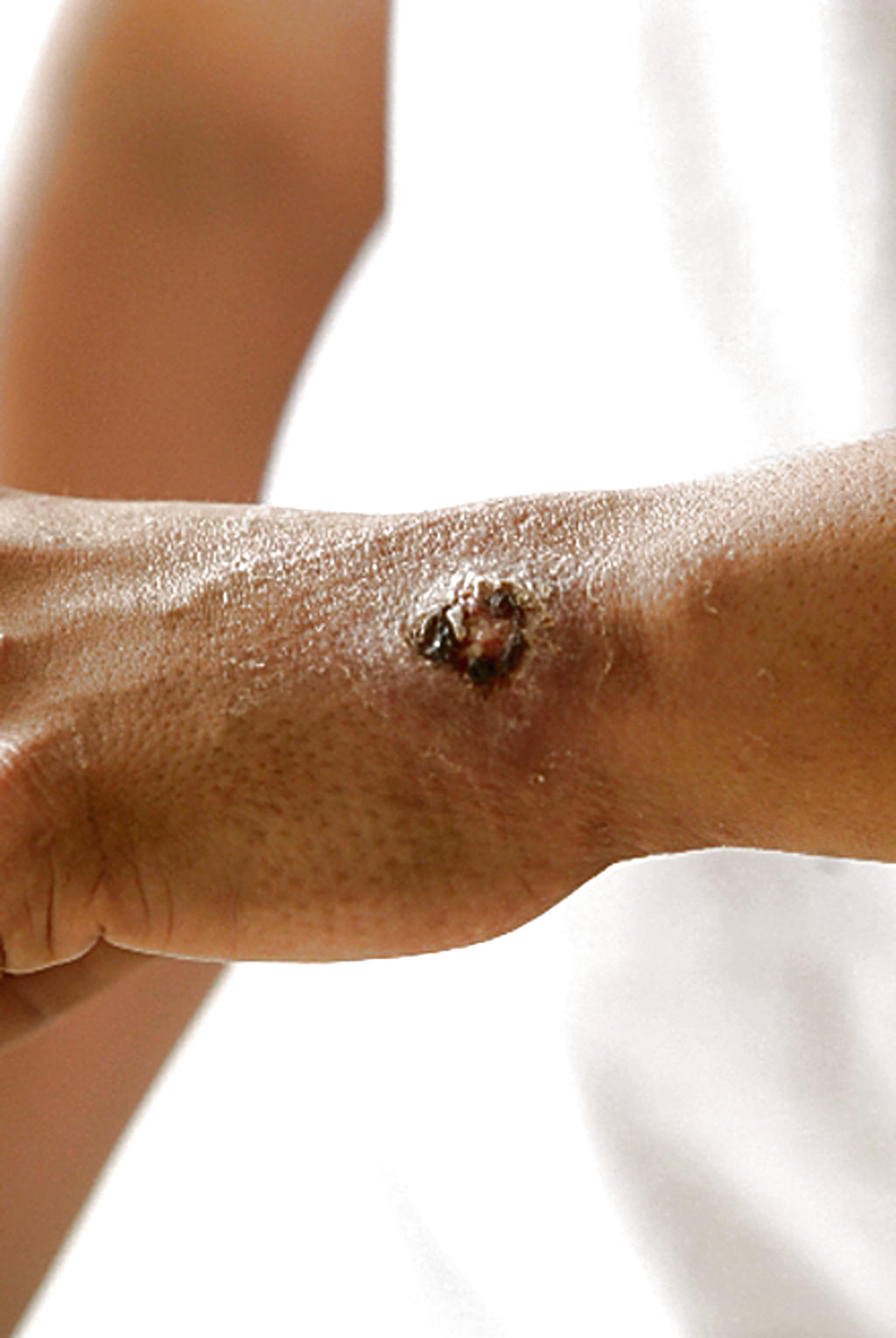 Se debaten entre remedios naturales y las vacunas | Panamá América